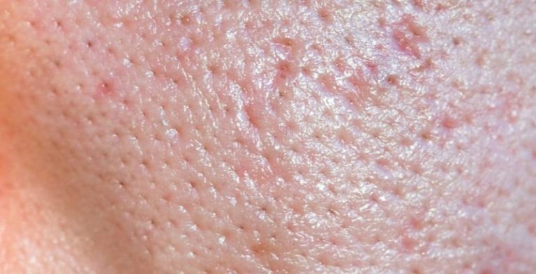 Best Makeup For Large Pores Best Pasties 1182